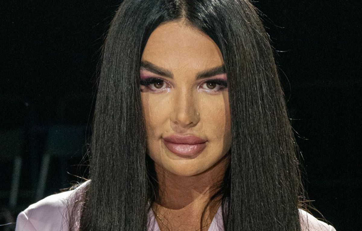 Toto neurobí hocikto. Zuzana Plačková sa ukázala bez zubov | TV Markíza